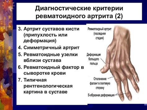 #поликлиническая_терапия_вопросы@otv6k ревматический артрит особенности ...