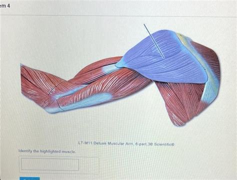 [solved] the highlighted muscle originates from which bone