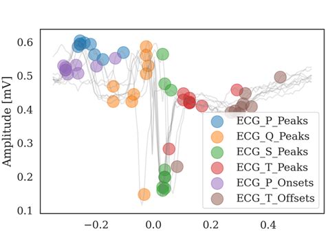 Visual Summary Of The Segmentation Of P Q S And T Peak Onsets And Download Scientific Diagram