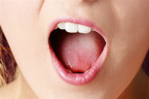 Morphea Scleroderma News