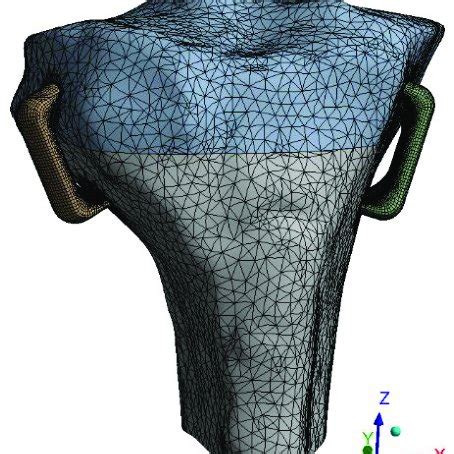 FEM Model Of The Bone And Staples Download Scientific Diagram