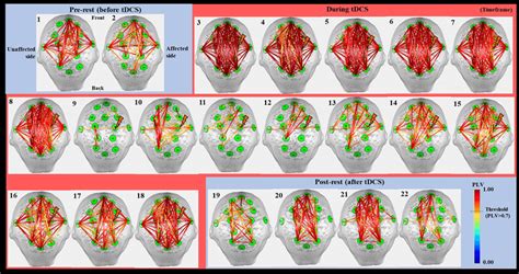 The Cortical Synchrony Results Analyzed By Using The Optonet Ii ® Download Scientific Diagram