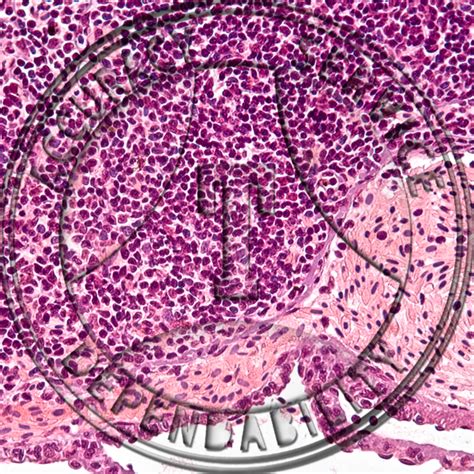 Parathyroid Microscope Slide