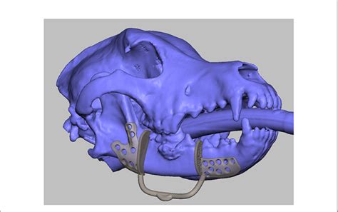 Figure E Model Of A Surgical Guide For Mandibulectomy And Reconstruction Download Scientific