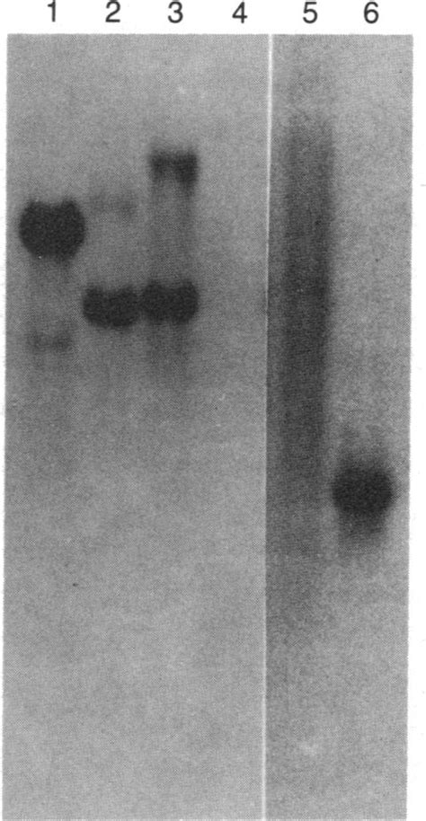 Rna Gel Blot Analysis Of The Intermolecular Base Pairing Capabilities Download Scientific