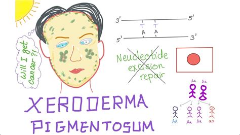Xeroderma Pigmentosum Youtube