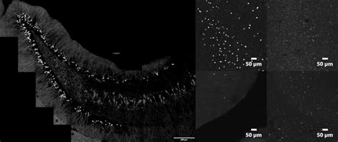Quantification Of C Fos Positive Neurons In Mouse Brain Sections Using