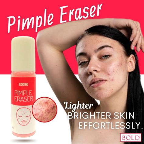 Bold Pimple Eraser 10ml Breakout Control Scar Repair Minimize Pores Anti Fungal Whitening