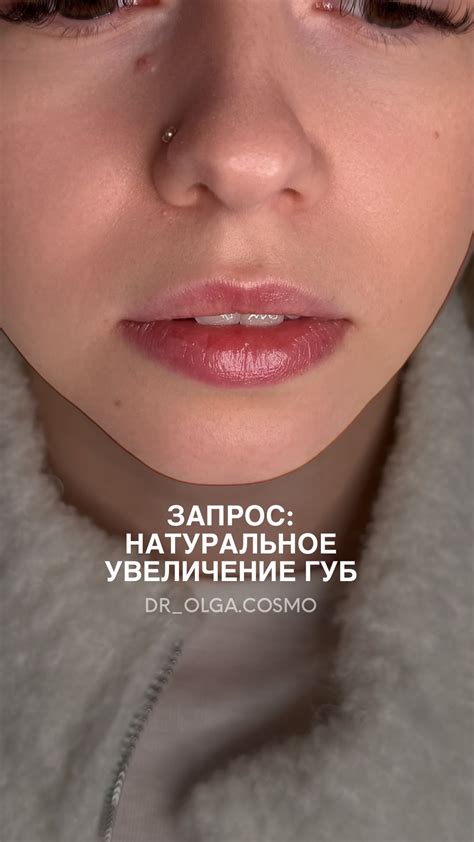 Врач косметолог Спб Москва обучение губы ботокс Full Face Дорого не значит качественно 🙏🏻