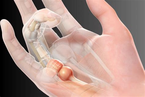 What Is A Trigger Finger Symptoms Causes And Treatment