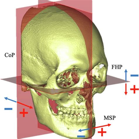 Kernahan And Starks Classification Download Scientific Diagram