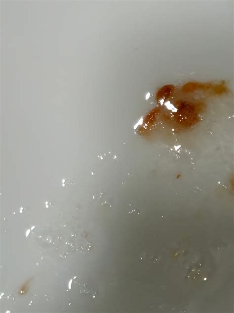 인후통 가래 피 지식in