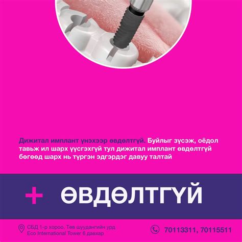 G Implant G Implant Added A New Photo