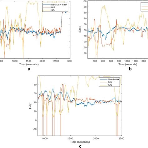 The Comparison Of The New Index And The Bis Index A Patient Id 9 B Download Scientific