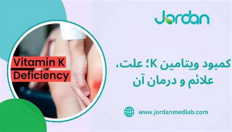 کمبود ویتامین K؛ علت، علائم و درمان آن آزمایشگاه جردن