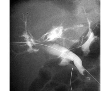 MIR Teaching File Case Hs