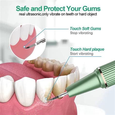 Dental Scaler Для удаления зубного камня Электрический очиститель зубов ...