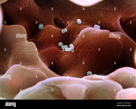 Mrsa Bacteria Coloured Scanning Electron Micrograph Sem Methicillin Resistant Staphylococcus