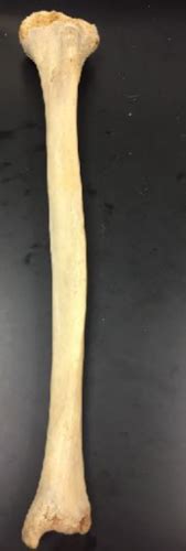 Tibia Flashcards Quizlet