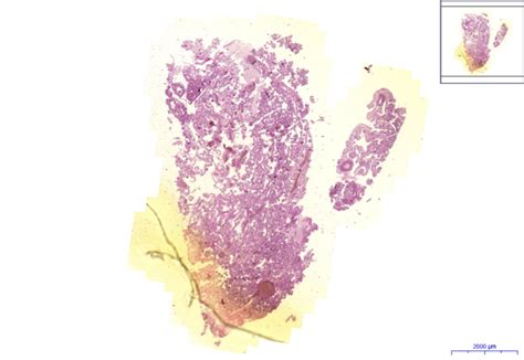 Plexus Choroideus He Wikiskripta