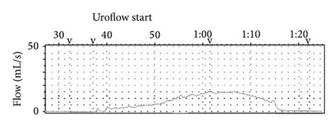 Uroflow After The Operation Revealed An Increased Flow With A Maximal Download Scientific