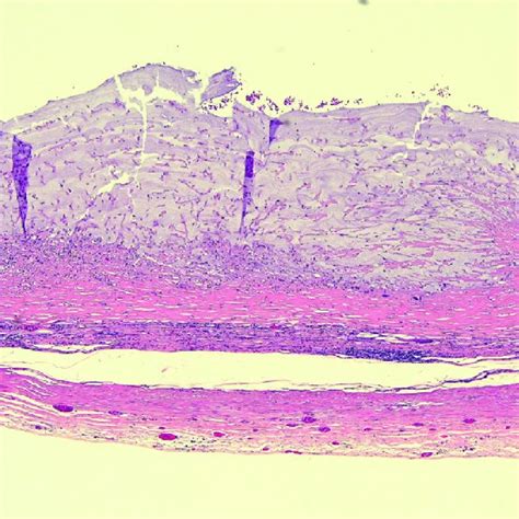 The Appendix Is Lined By Columnar Epithelium With Apical Mucin And Download Scientific Diagram