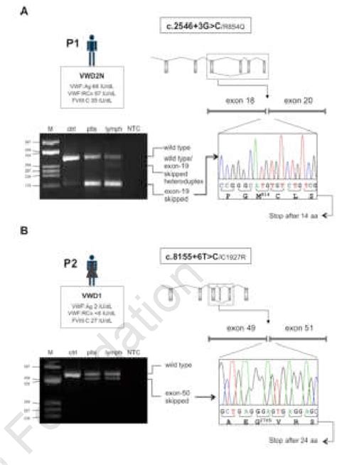 Figure 1 From Premature Termination Codon Mutations In The Von Willebrand Factor Gene Are