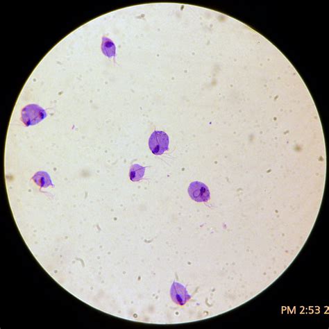 Trofo De Trichomonas Vaginalis Trichomonas Vaginalis Computer