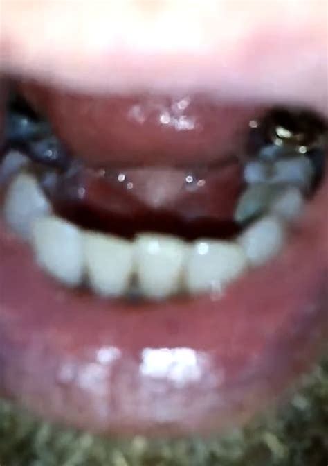 Mouth And Vore Fetish Thisvid Com