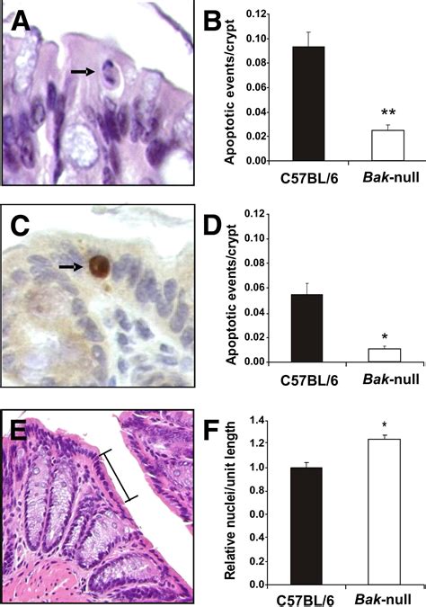 Suppression Of Apoptosis Crypt Hyperplasia And Altered