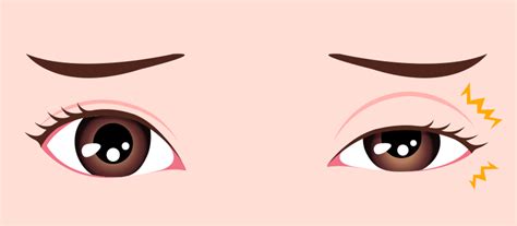 Why Is My Eye Twitching Potential Causes