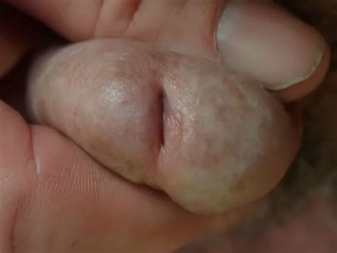 Close Up Penis 14 Pics Xhamster