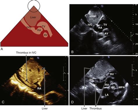 Echocardiography Radiology Key