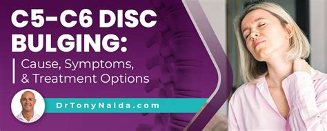 C5 C6 Disc Bulging Cause Symptoms And Treatment Options