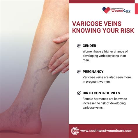 Varicose Veins Pregnancy