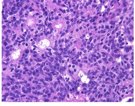 There Are Numerous Duct Like Spaces With Non Ciliated Columnar Download Scientific Diagram