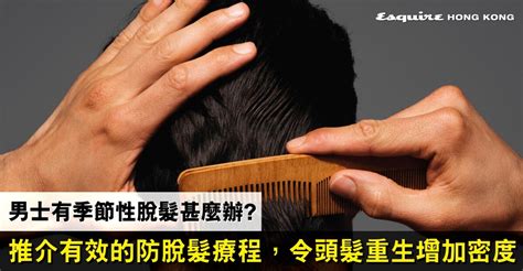 男士有季節性脫髮甚麼辦？推介有效的防脫髮療程，令頭髮重生增加密度