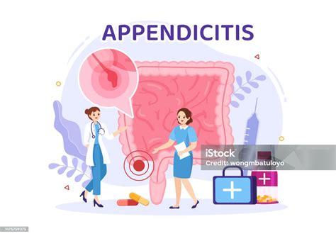 Appendicitis Illustration With Inflammation Of The Appendix And Stomach