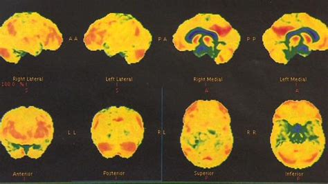 Ddrc Srl Mdddrc Twitter