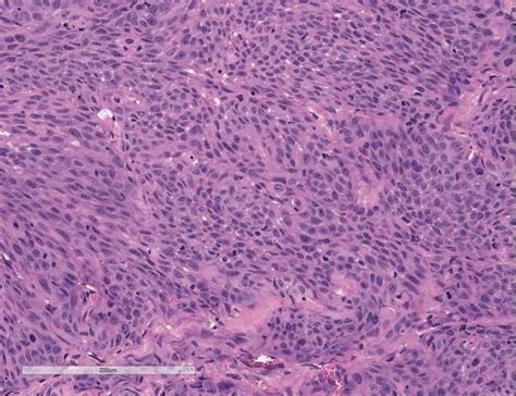 Featured Pdx Models The Jackson Laboratory