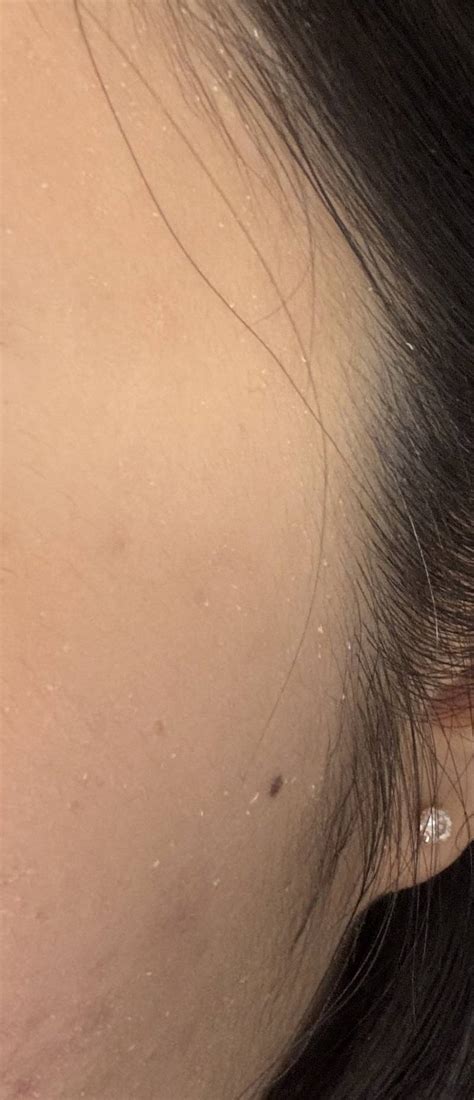 잡담 피부화장 이렇게 되는건 뭐가 문제야 인스티즈instiz 일상 카테고리