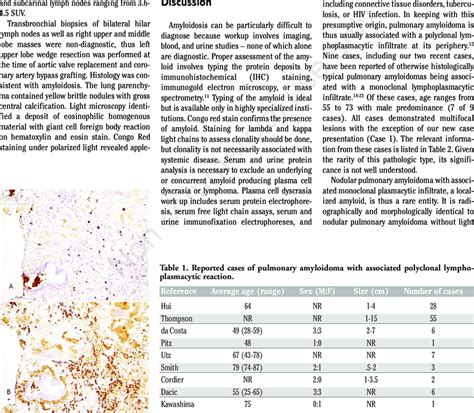 Immunohistochemistry For Kappa A And Lambda B Light Chains Reveals Download Scientific