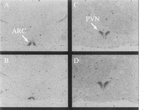 Structure Of Paraventricular Nucleus Semantic Scholar