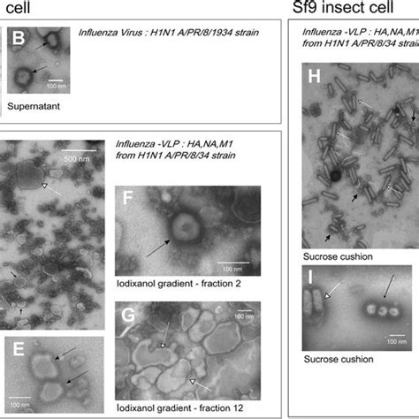 Generation Of Bacmam Expression Construct And Bacmidviral Production