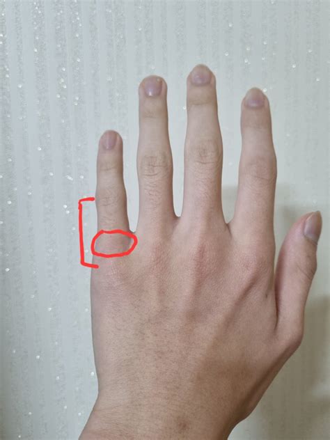 새끼손가락 통증 지식in