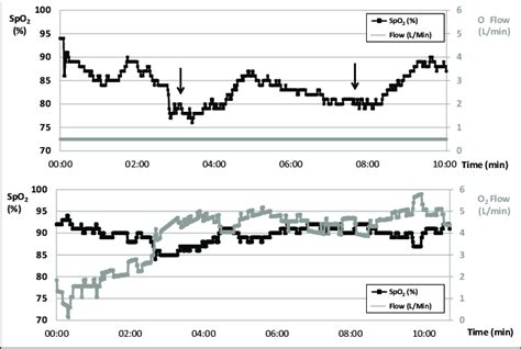 Typical Variations During Exercise Of Oxygenation Oxygen Saturation Download Scientific
