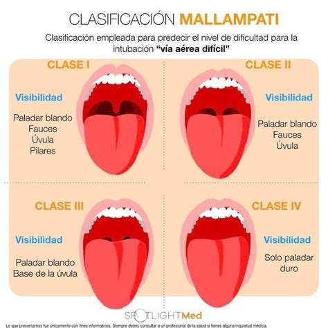 Clasificación Mallampati Estudiante De Medicina Clases De Enfermeria