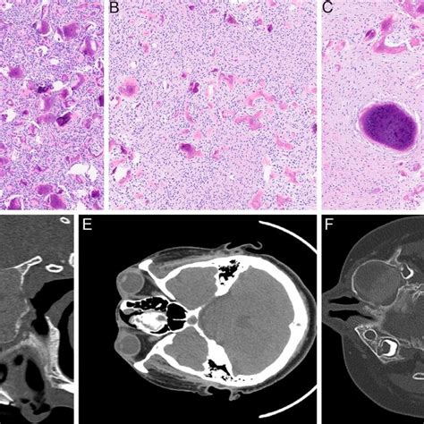 Genomic Profiles Of 17 Ossifying Fibromas Highlighting Recurrent Download Scientific Diagram
