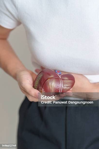 인간의 간 해부학 모델을 들고 있는 여자 간암 및 종양 황달 바이러스성 A B C D E 간경변 부전 비대 간성 뇌병증 복수액 및 건강 10월에 대한 스톡 사진 및 기타