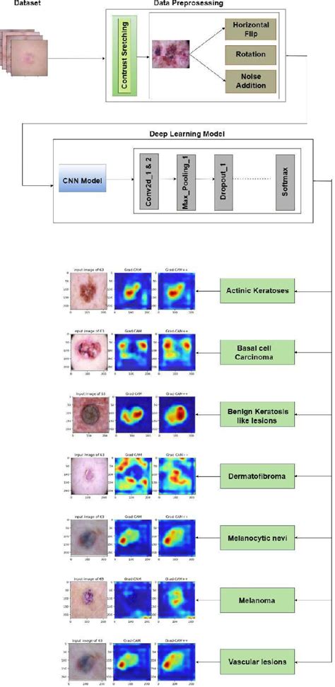 Figure 1 From An Interpretable Skin Cancer Classification Using Optimized Convolutional Neural